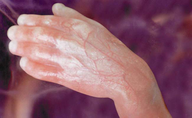 When And How Fingerprints Form Lozier Institute