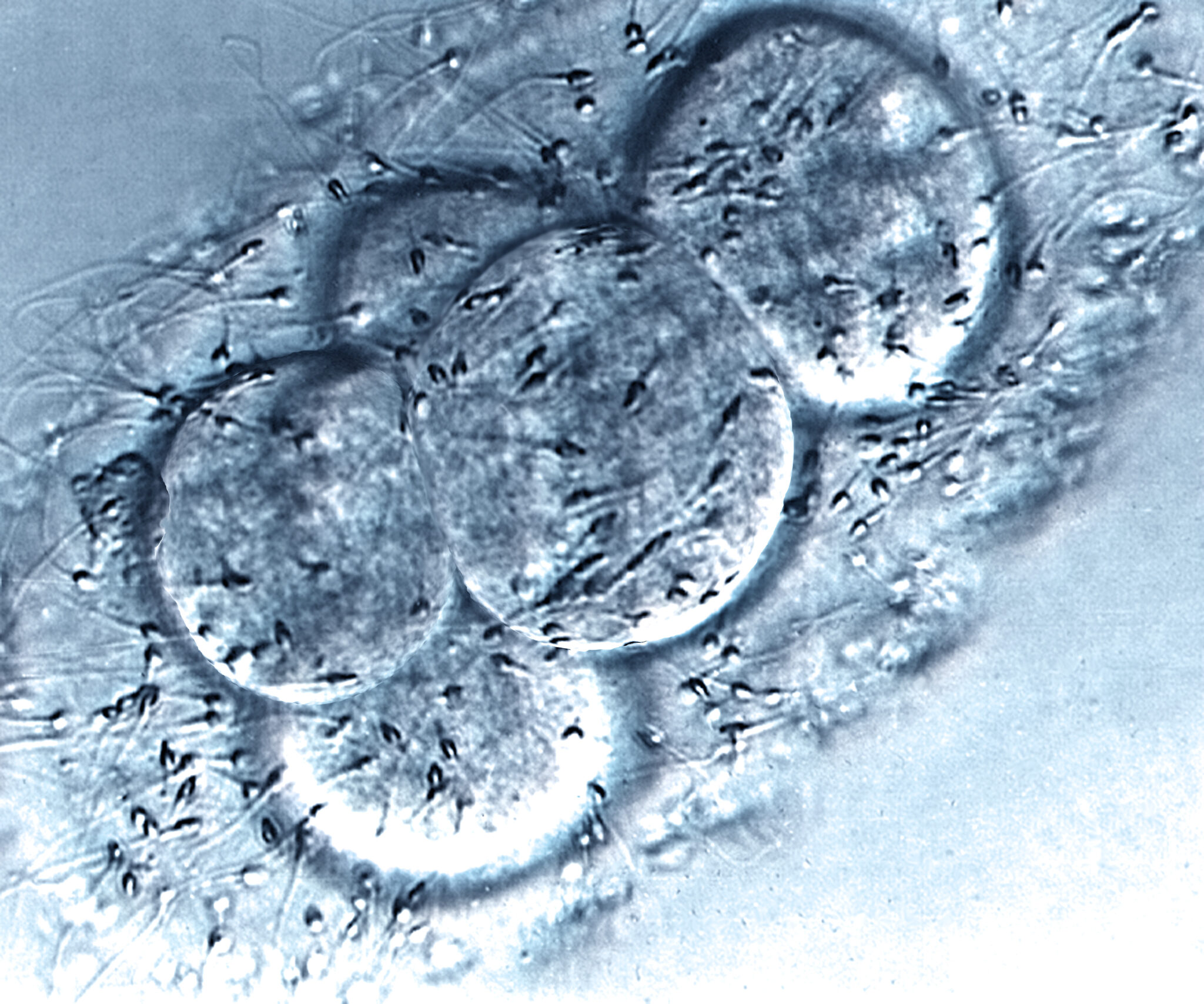 Use of Aborted Fetal Tissue: Questions & Answers - Lozier Institute